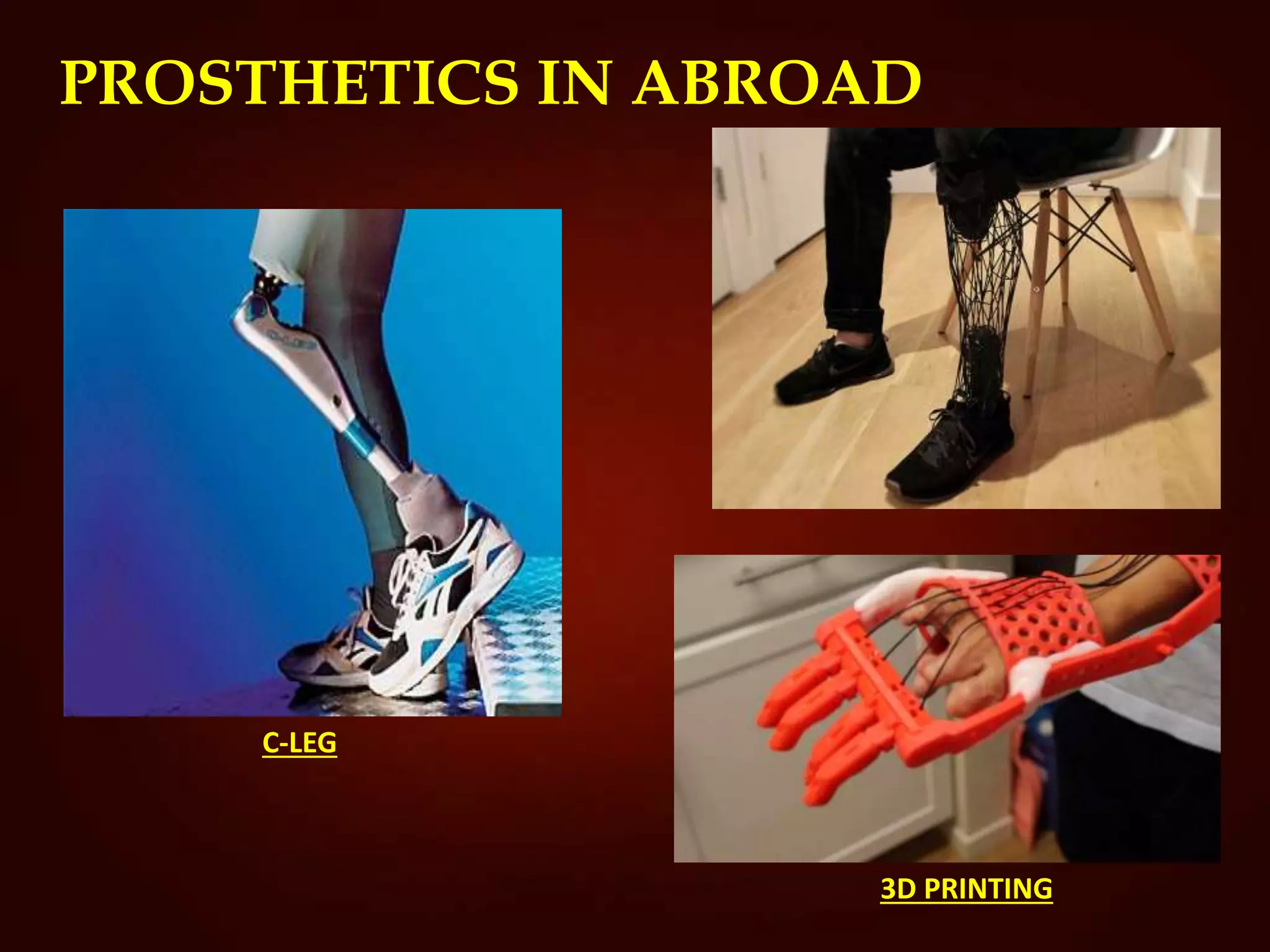 Prosthetic devices | PPTX