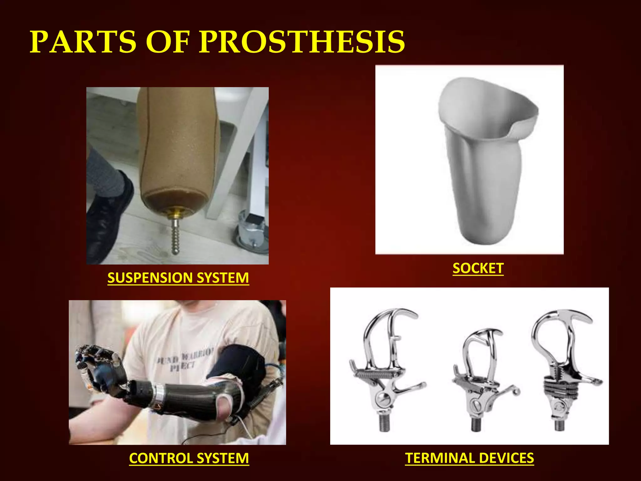 Prosthetic devices | PPTX