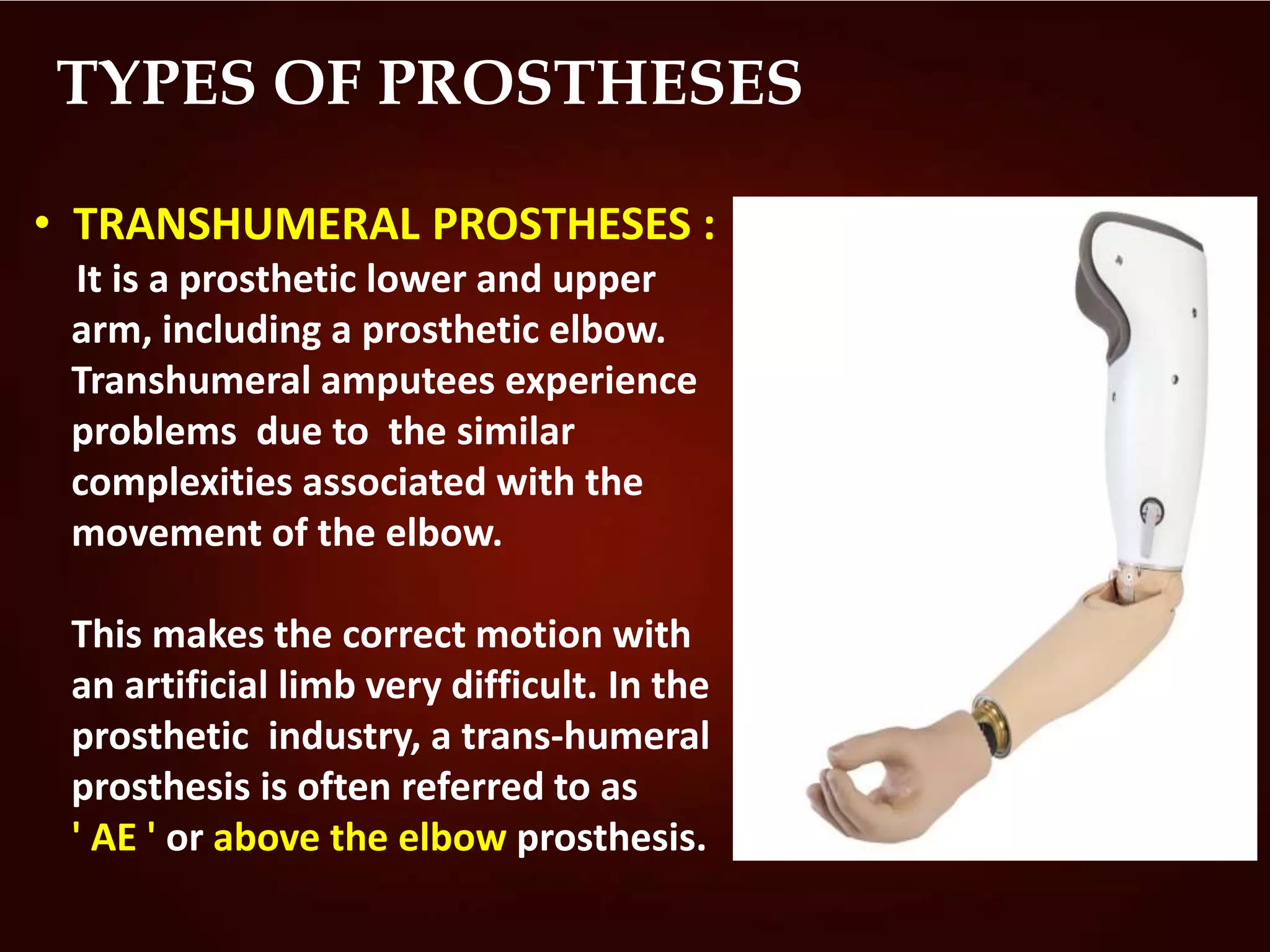 Prosthetic devices | PPTX