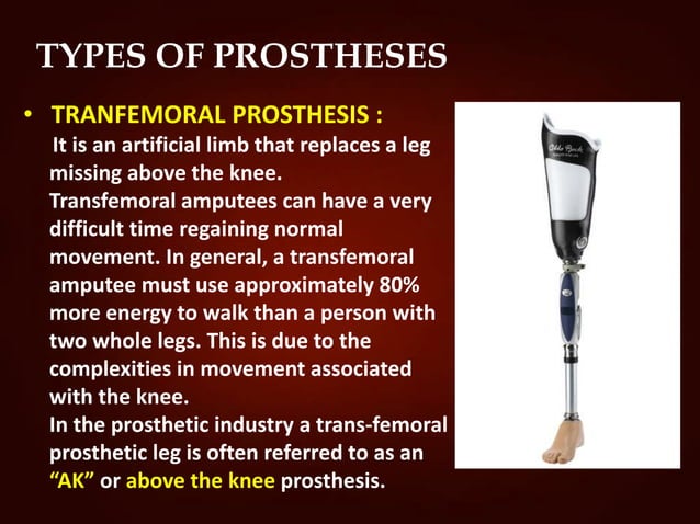 Prosthetic devices | PPTX