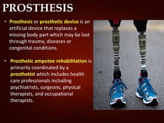 Prosthetic devices | PPTX
