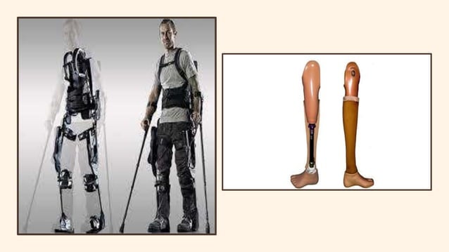 USES OF PROSTHETIC DEVICES FOR REHABILITATION | PPTX | Death, Injury ...