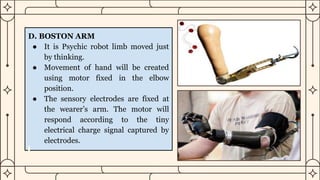 USES OF PROSTHETIC DEVICES FOR REHABILITATION | PPTX