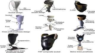 USES OF PROSTHETIC DEVICES FOR REHABILITATION | PPTX