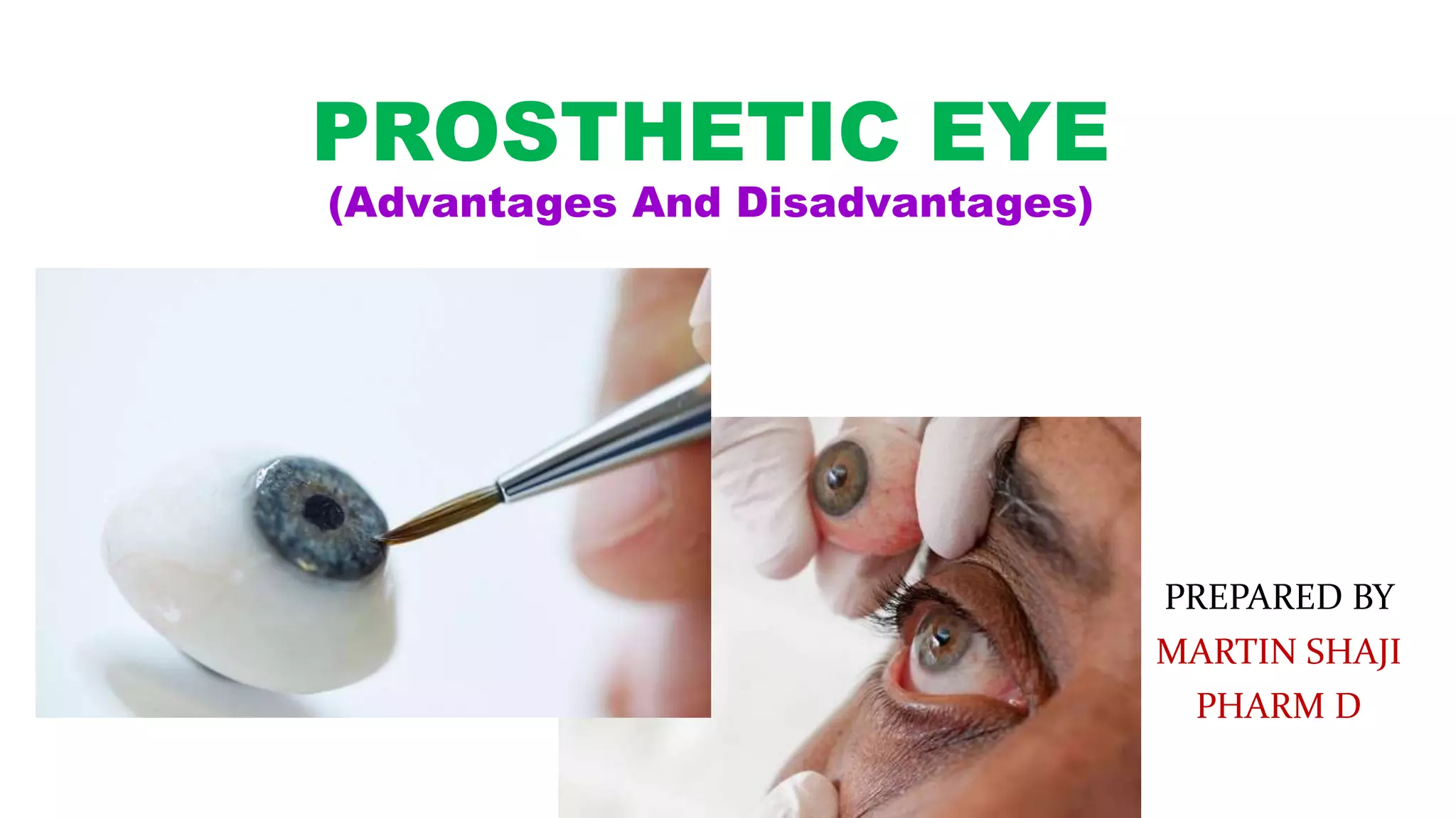 Prosthetic eye( advantages & disadvantages)- in brief | PPTX