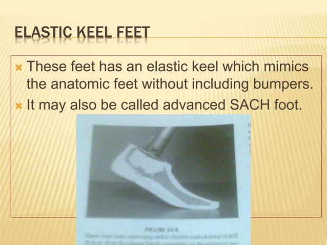 PROSTHETIC FEET.pptx