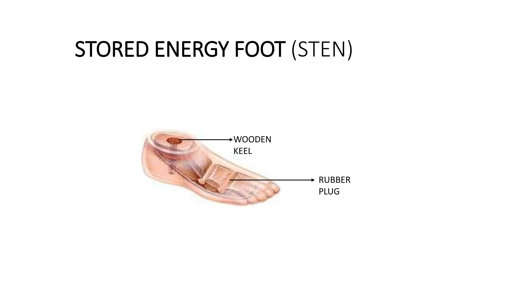 PROSTHETIC FEET description and its types | PPTX