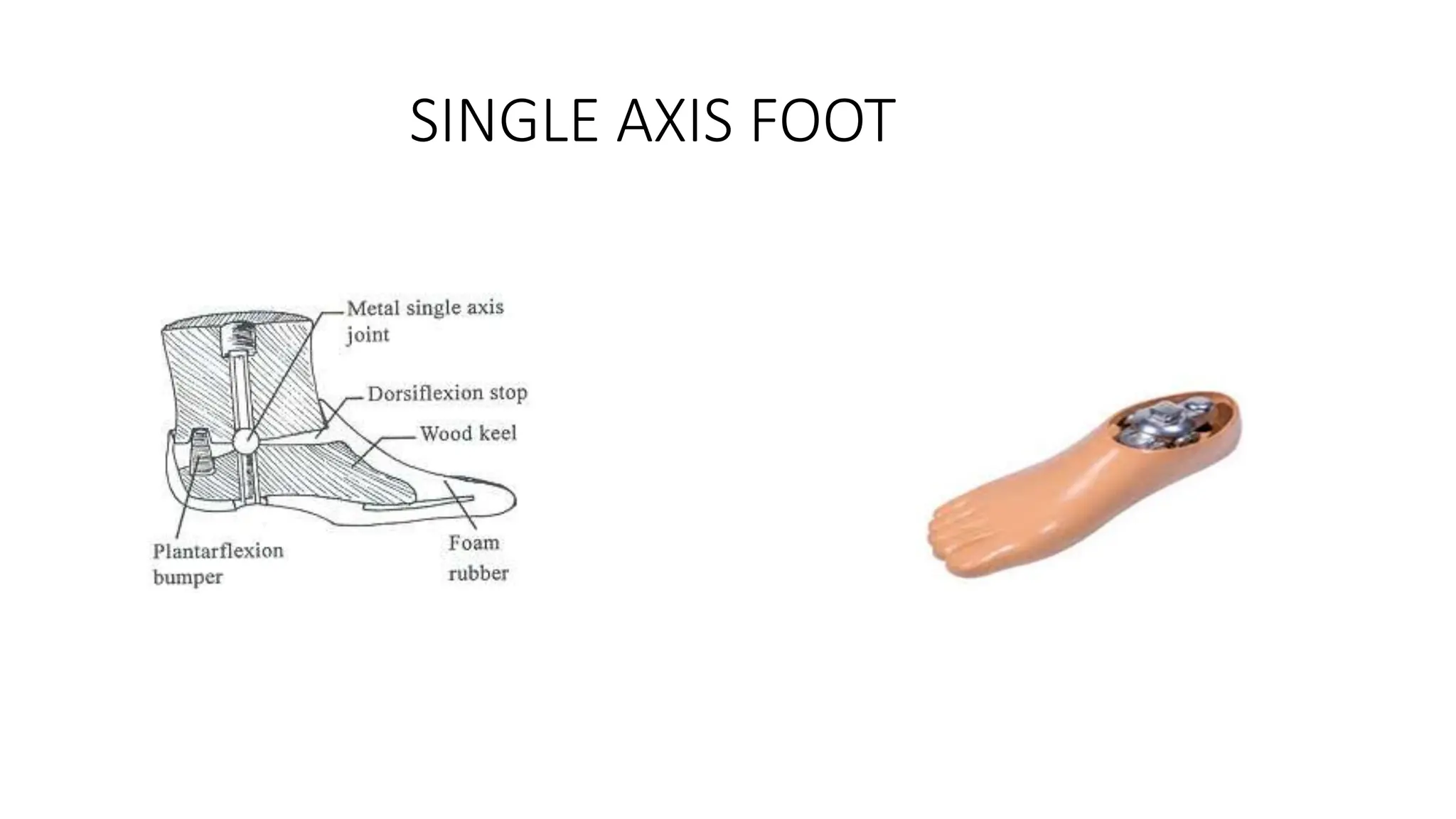 PROSTHETIC FEET description and its types | PPTX