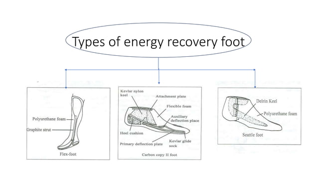 PROSTHETIC FEET description and its types | PPTX