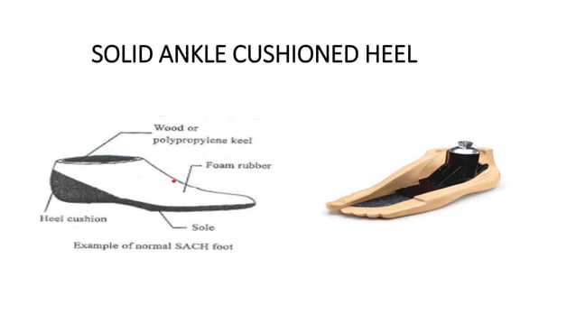 PROSTHETIC FEET description and its types | PPTX