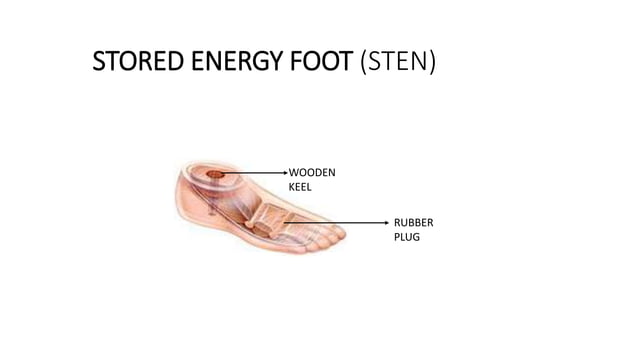 PROSTHETIC FEET description and its types | PPTX