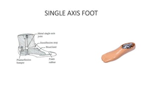 PROSTHETIC FEET description and its types | PPTX