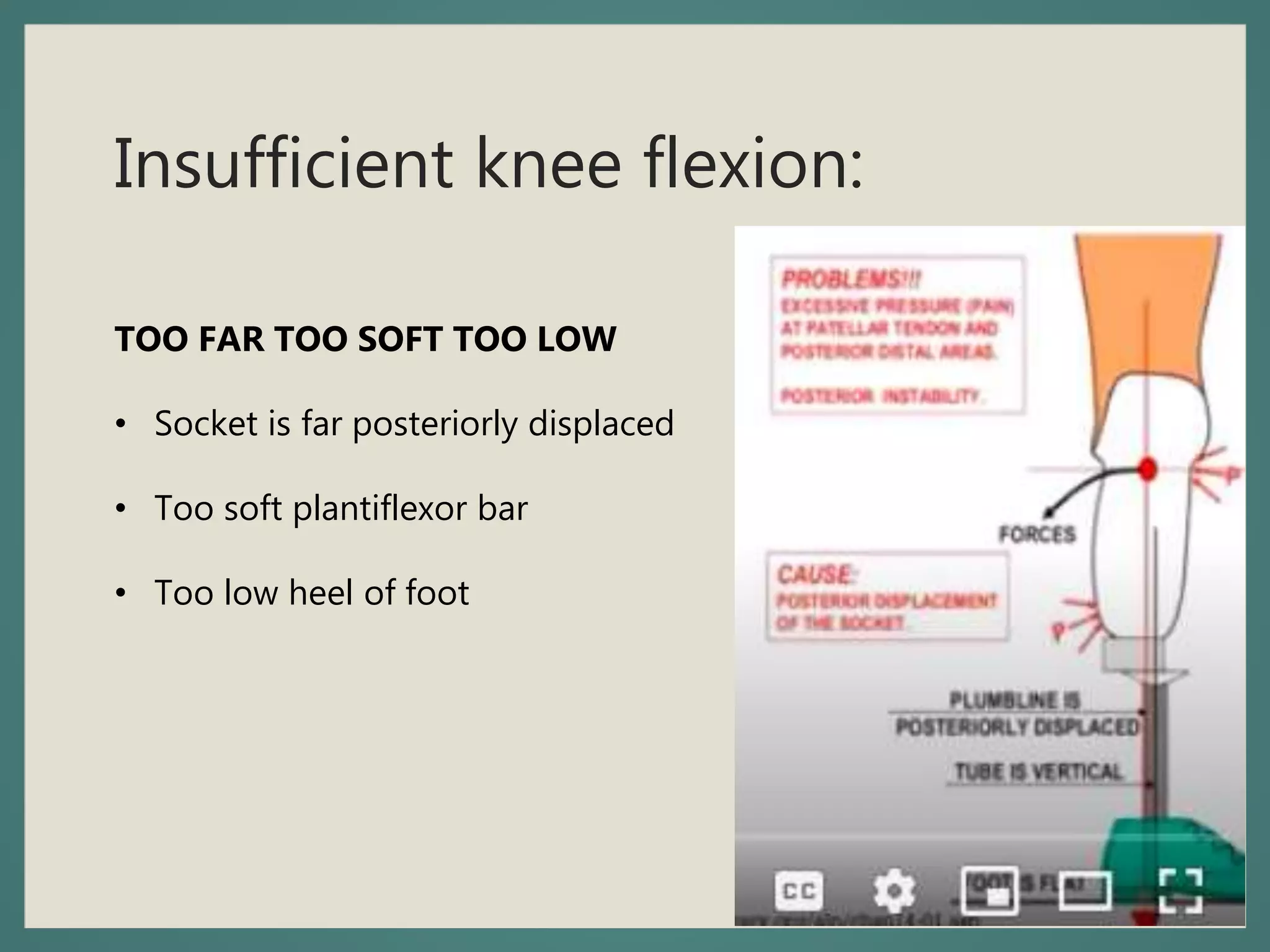 Prosthetic gait deviation | PPTX