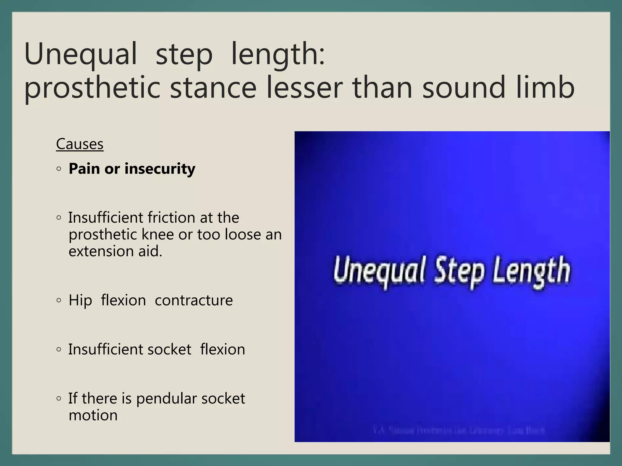 Prosthetic gait deviation | PPTX