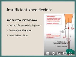 Prosthetic gait deviation | PPTX