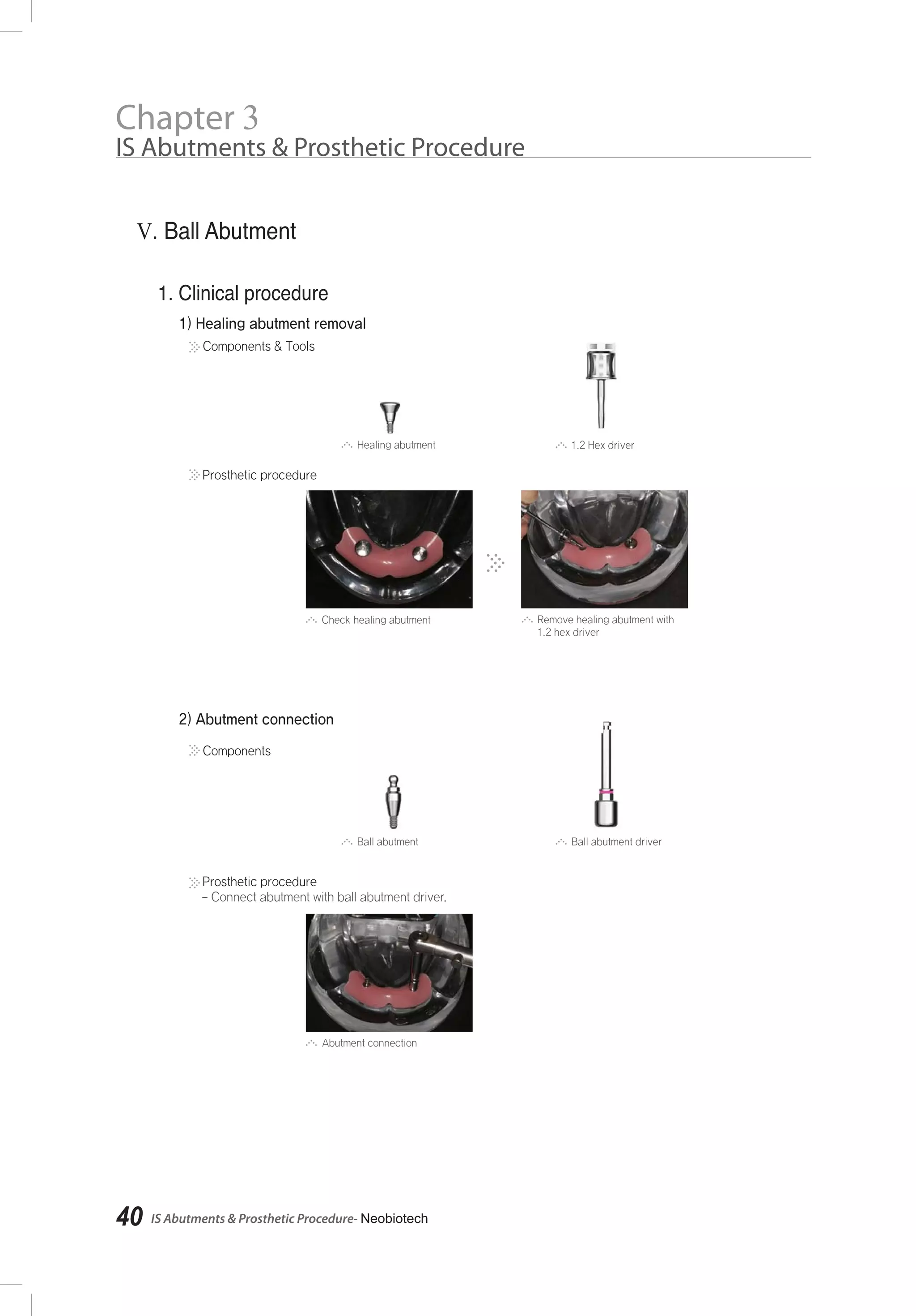 Prosthetic guide - 151210 update | PDF