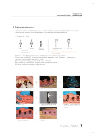 Prosthetic guide - 151210 update | PDF