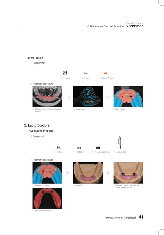 Prosthetic guide - 151210 update | PDF