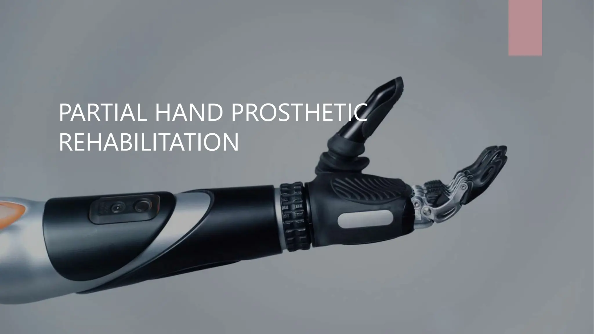 Partial hand prosthetic rehabilitation.pptx
