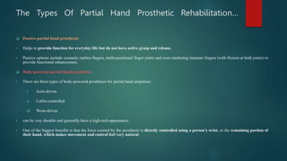 Partial hand prosthetic rehabilitation.pptx