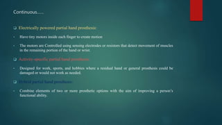 Partial hand prosthetic rehabilitation.pptx