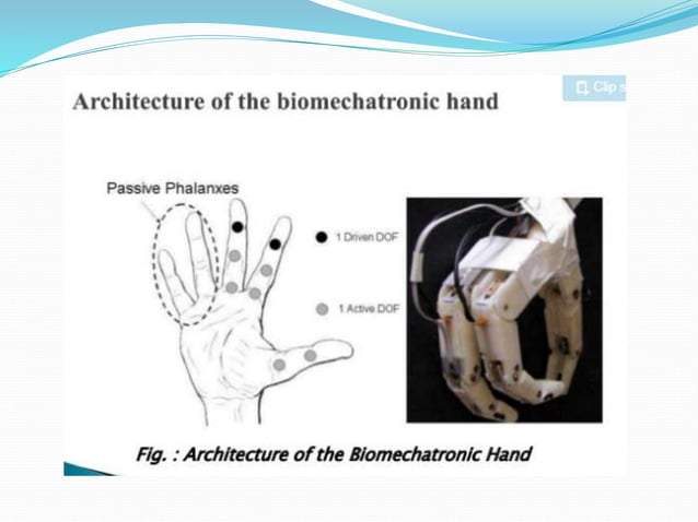 Prosthetic hand ppt | PPTX