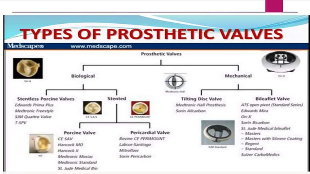 Prosthetic heart valves-1.pptx advance a | PPT