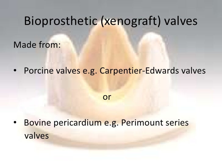 Prosthetic Heart Valves