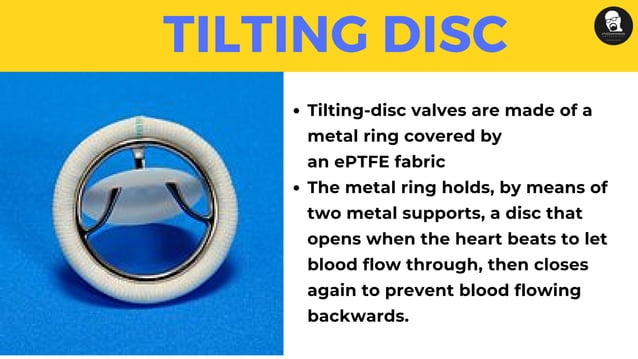 Prosthetic heart valves and its structures | PDF | Heart and ...