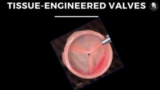 Prosthetic heart valves and its structures | PDF