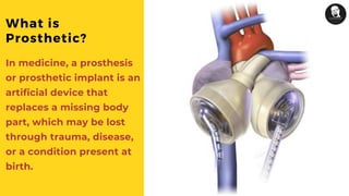 Prosthetic heart valves and its structures | PDF