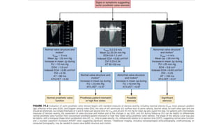 Prosthetic Heart Valves from Research Paper | PPTX