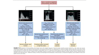 Prosthetic Heart Valves from Research Paper | PPTX