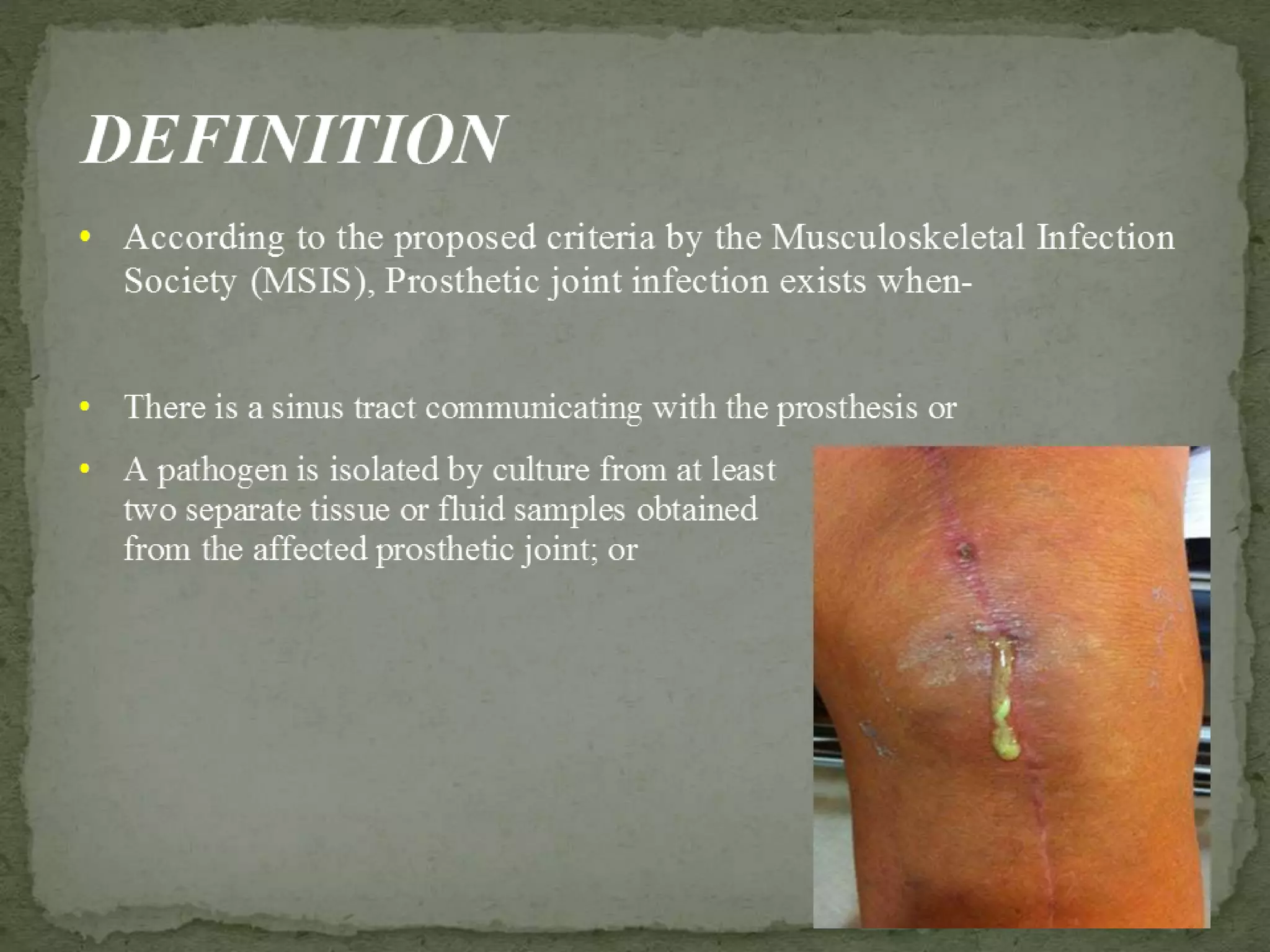 Prosthetic joint infections | PPTX