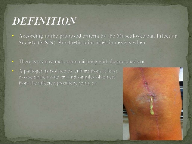 Prosthetic joint infections