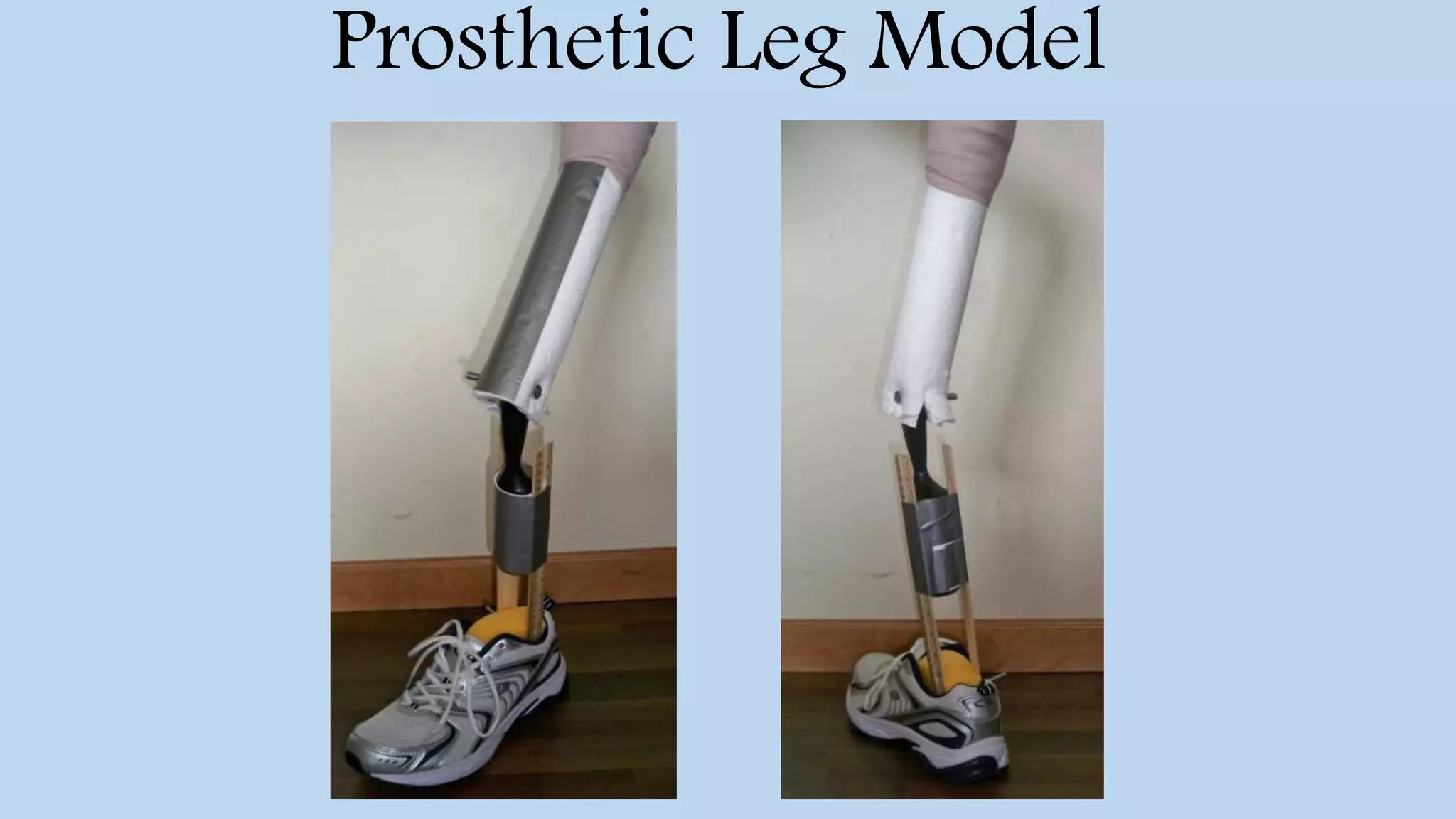 Prosthetic leg model | PPTX