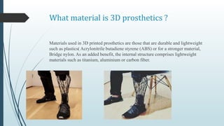 Prosthetic legs.pptx