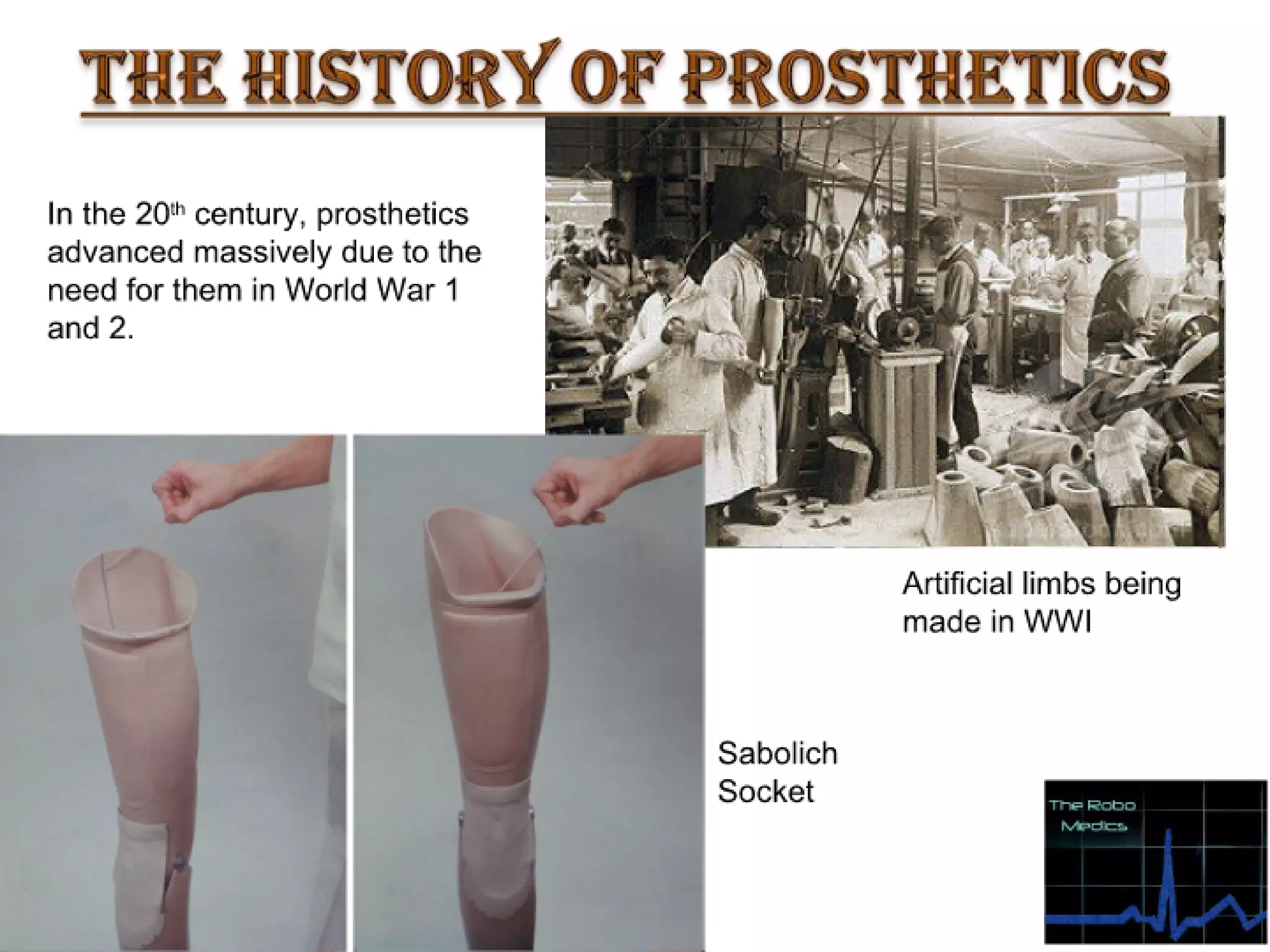 Prosthetic limbs final | PPT