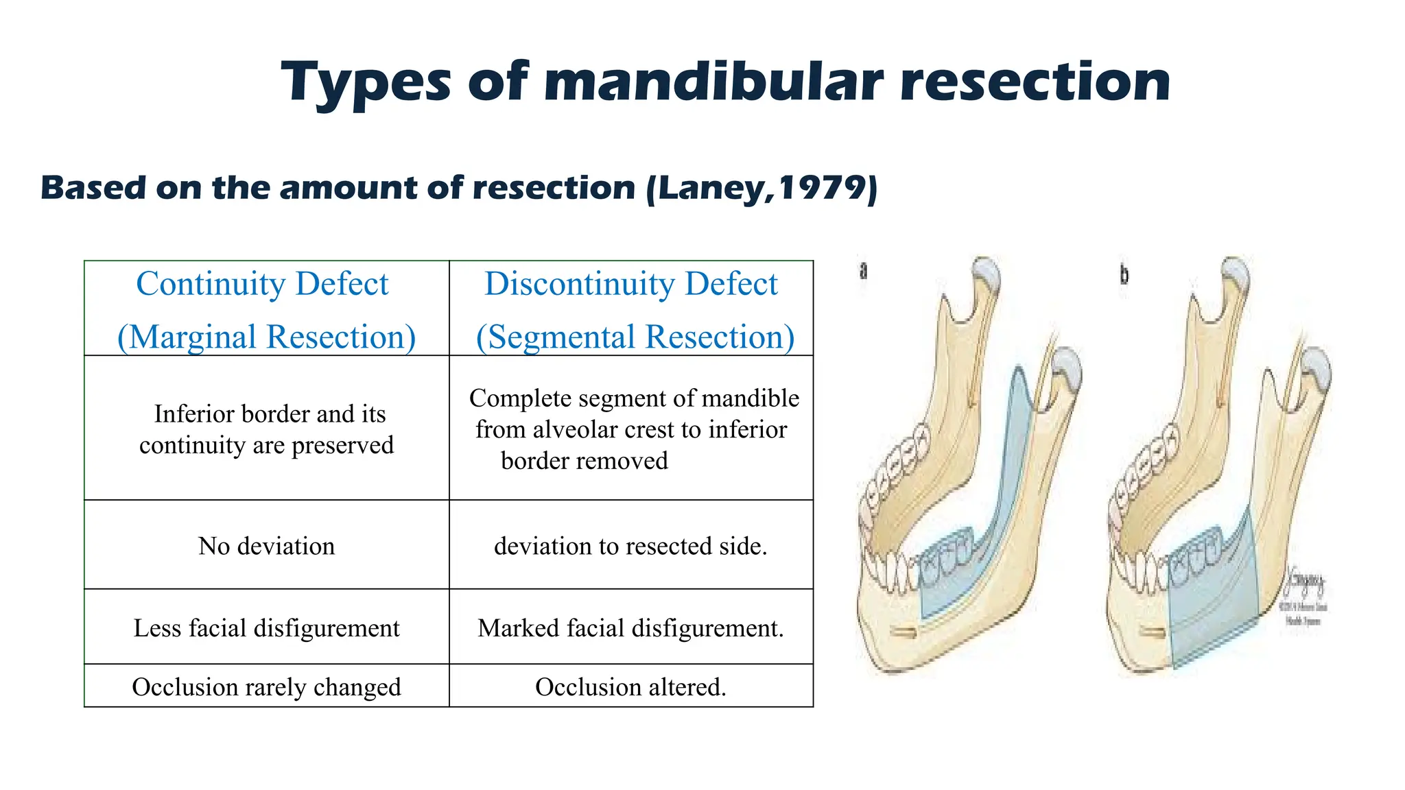 Prosthetic Management for Resected Mandible.pptx