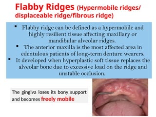 Prosthetic Management of Abused Tissues.ppt