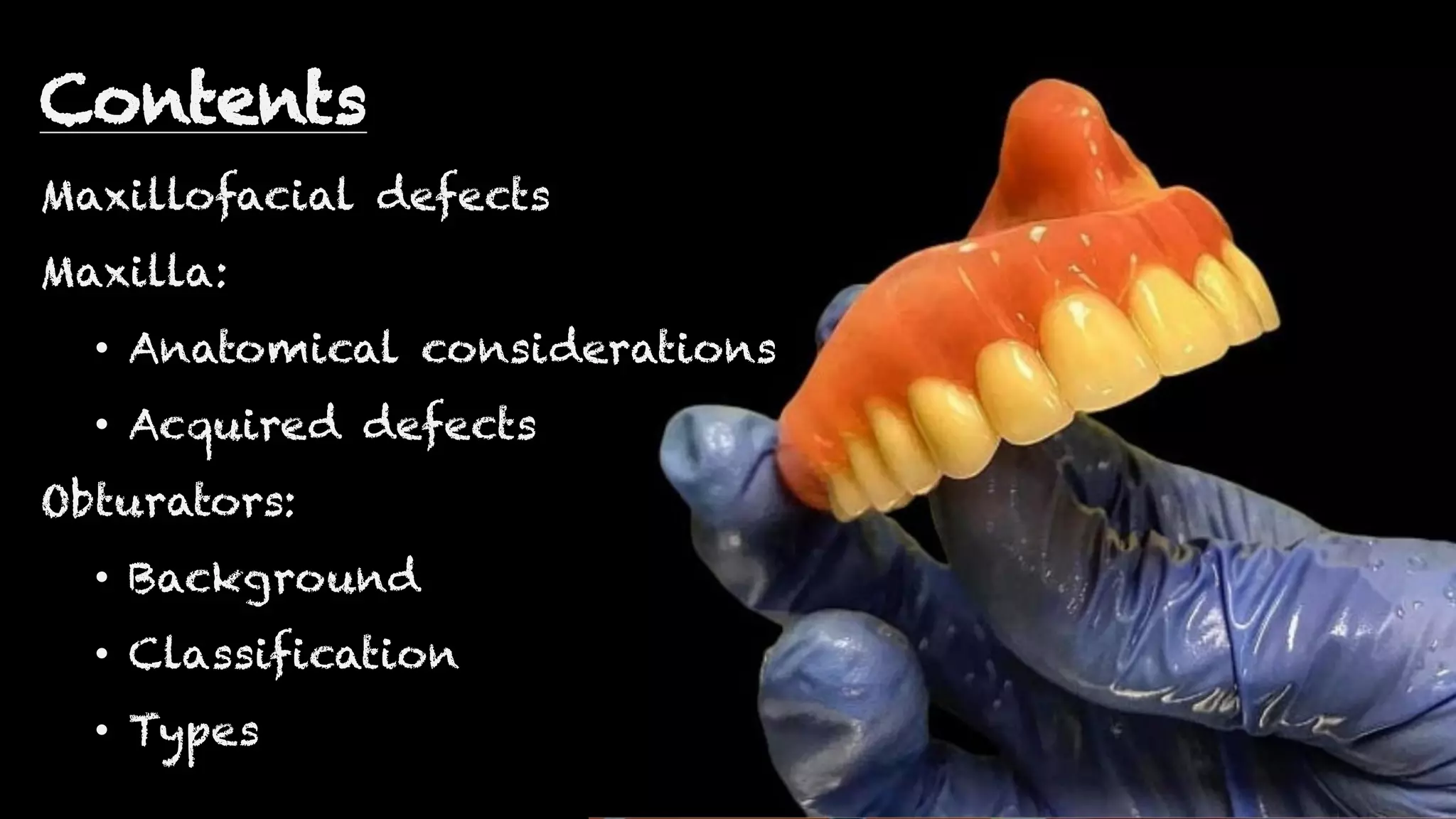 Prosthetic Management of Acquired Maxillary Defects | PDF