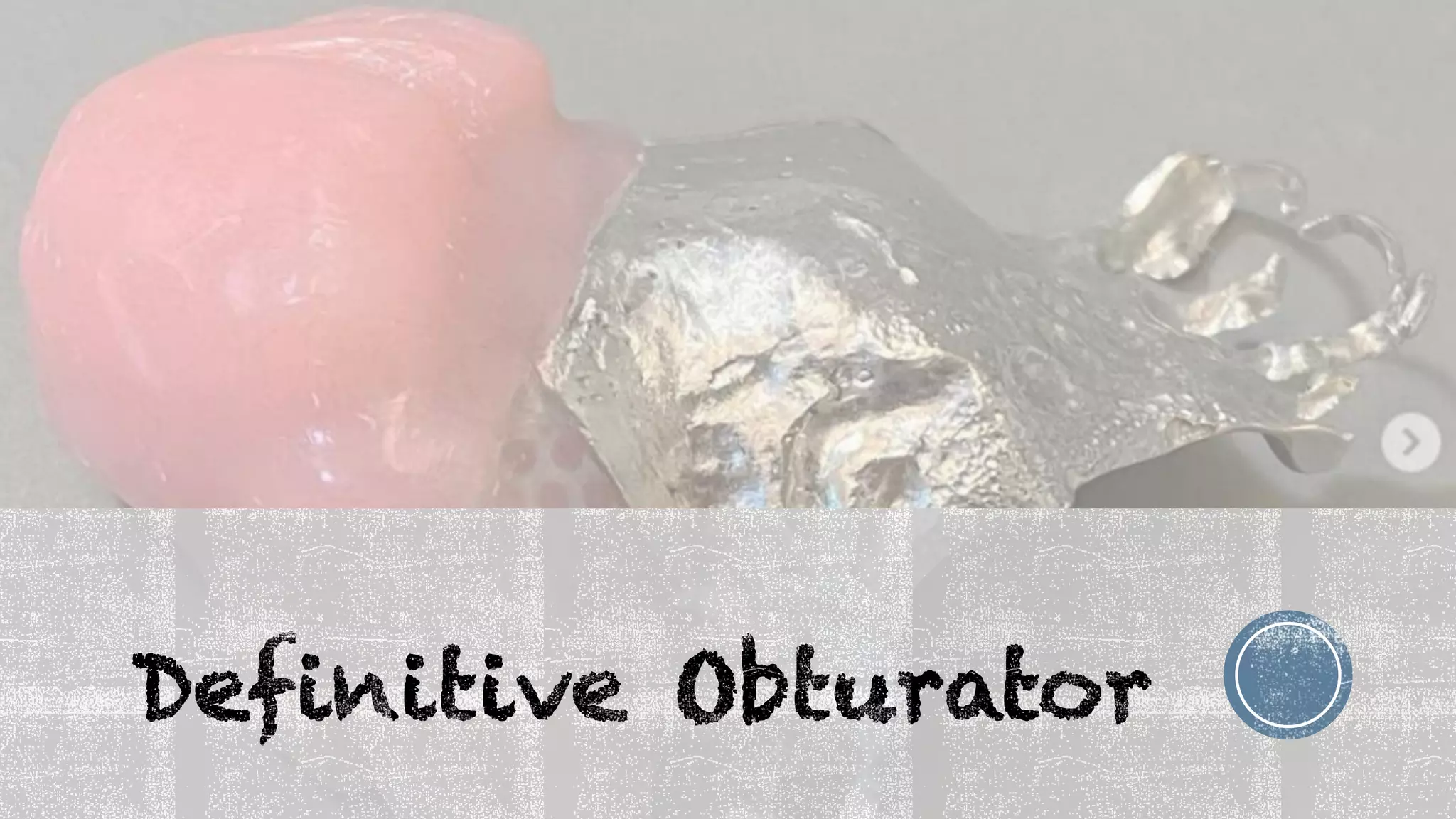 Prosthetic Management of Acquired Maxillary Defects | PDF | Ear, Nose ...