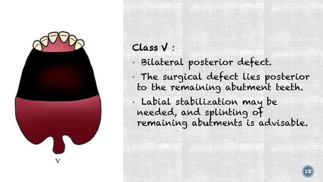 Prosthetic Management of Acquired Maxillary Defects | PDF | Ear, Nose ...