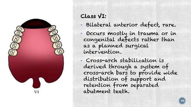 Prosthetic Management of Acquired Maxillary Defects | PDF | Ear, Nose ...