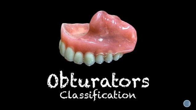 Prosthetic Management of Acquired Maxillary Defects | PDF | Ear, Nose ...