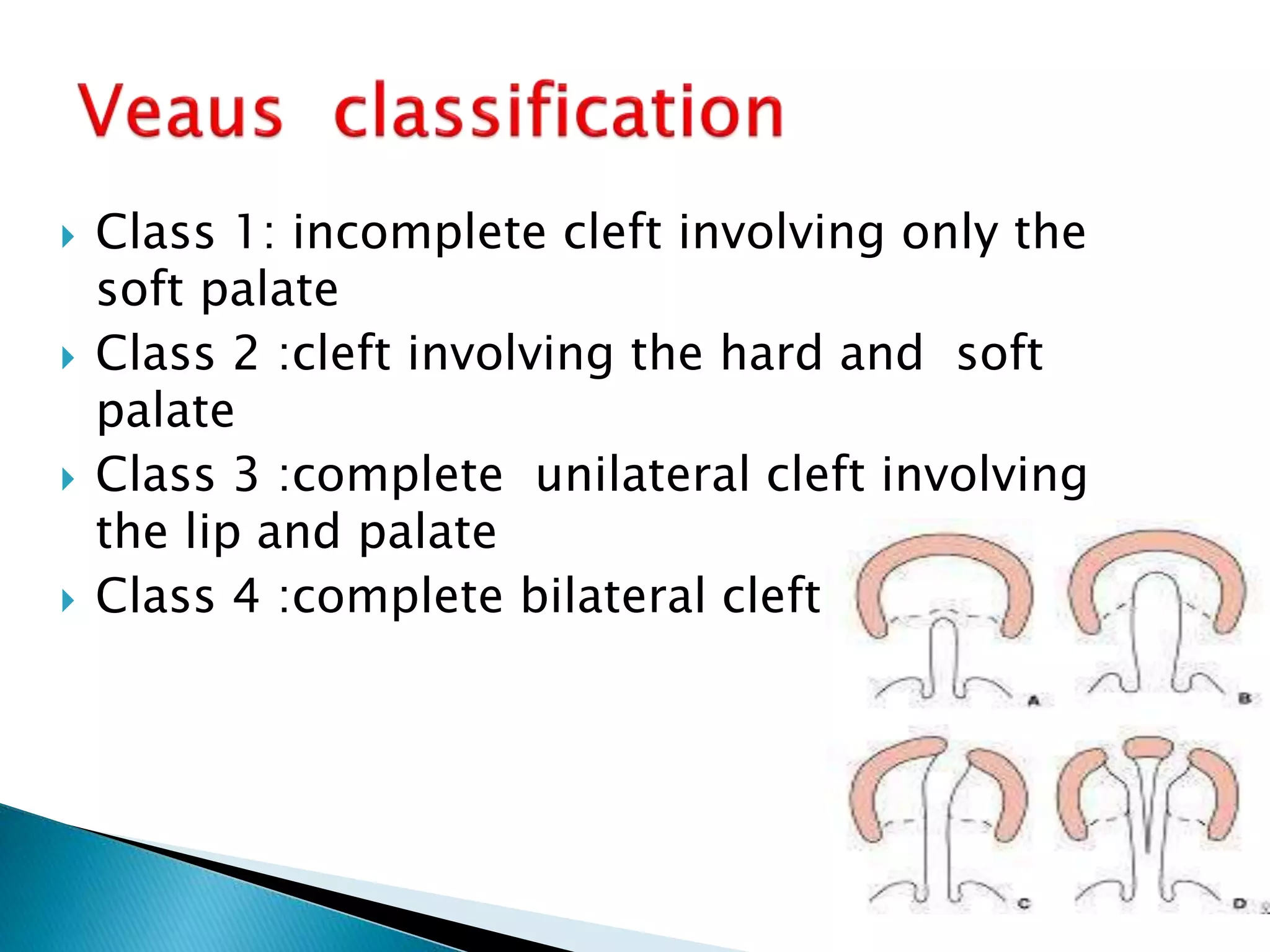 Prosthetic management of cleft lip and palate patient | PPTX