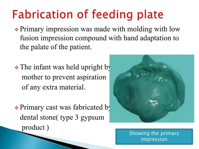 Prosthetic management of cleft lip and palate patient | PPTX | Dental ...