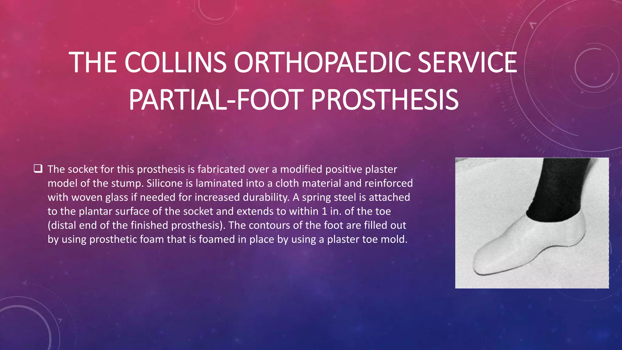 Prosthetic management of different levels of amputation | PPTX