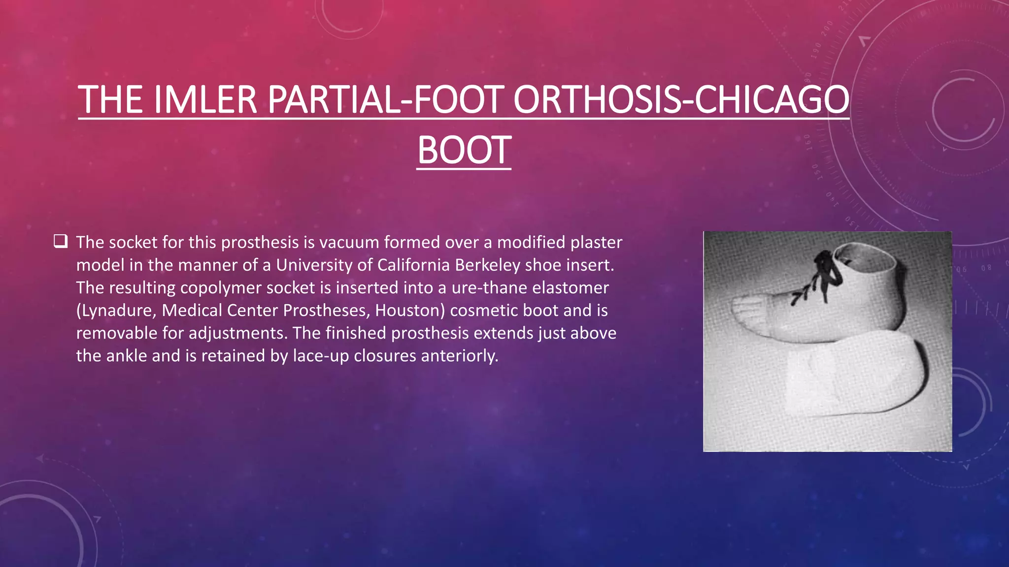 Prosthetic management of different levels of amputation | PPTX