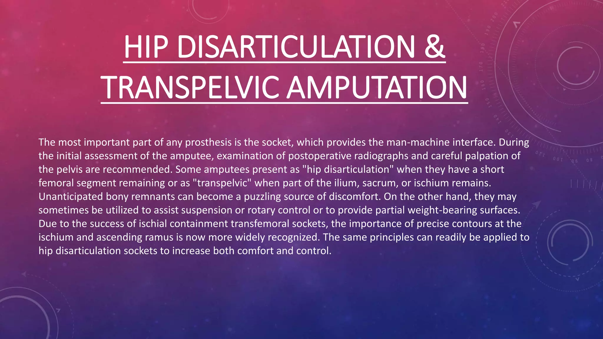 Prosthetic management of different levels of amputation | PPTX